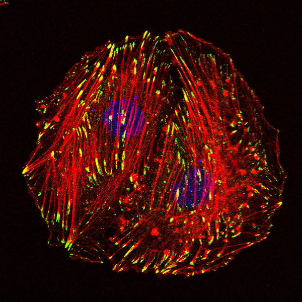 BioImaging Utrecht - Image Contest 2015 - the Winners - Cell Biology ...